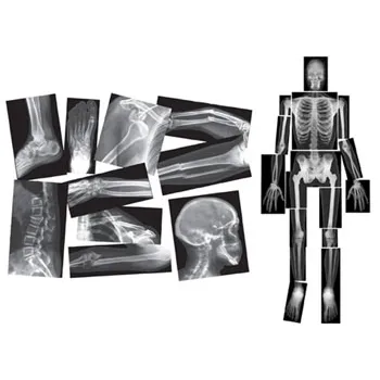 Human Bones X-Rays Kit