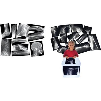 Broken & Fixed Bones Kit